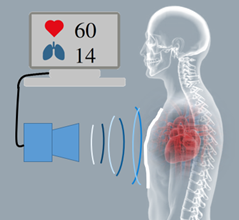 Radar-based Vital Sign Detection
