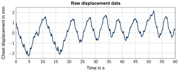 Radar-based Vital Sign Detection